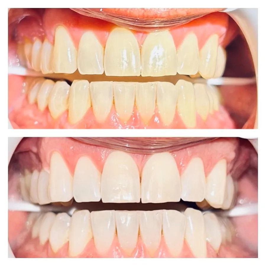 Dentist Foley AL | Cosmetic Dentistry